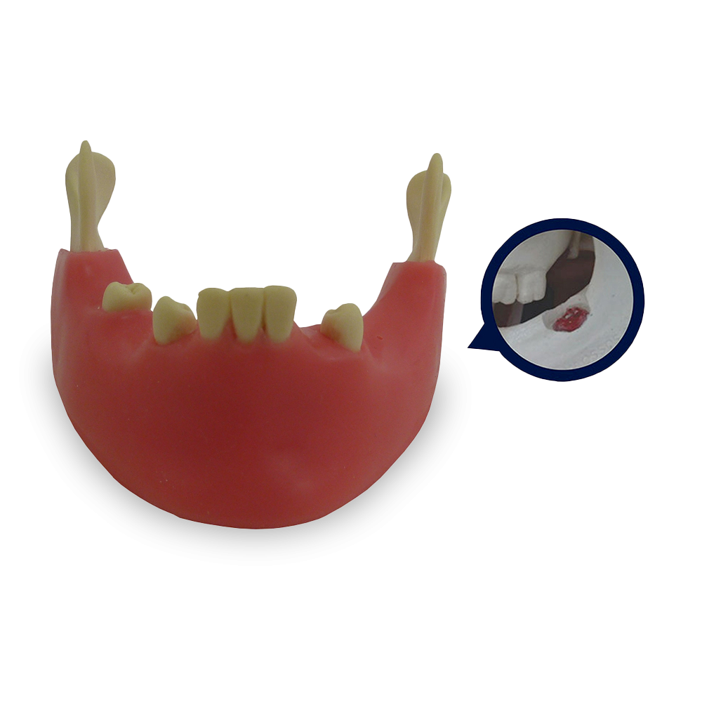 MANDÍBULA COM 3º MOLAR INCLUSO E GENGIVA - ODONTOLOGIA