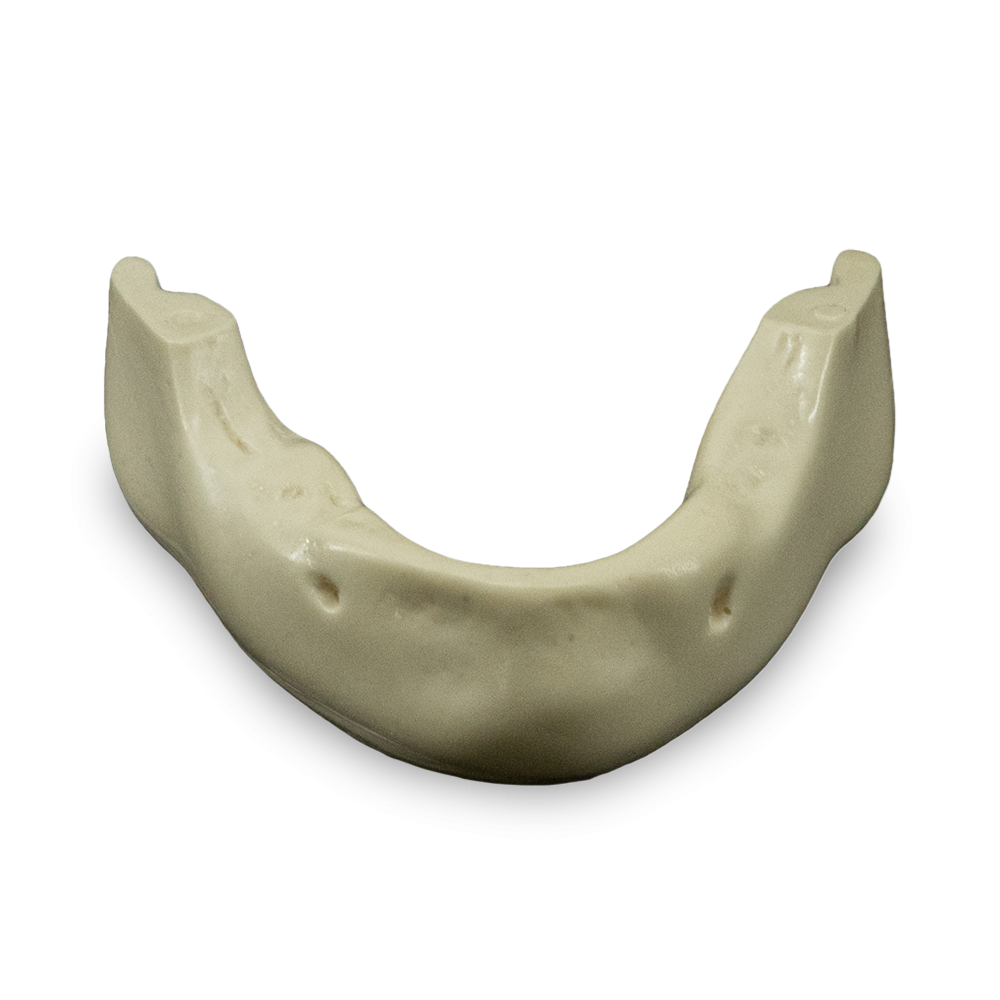 MANDÍBULA EDÊNTULA ANATÔMICA SLIM