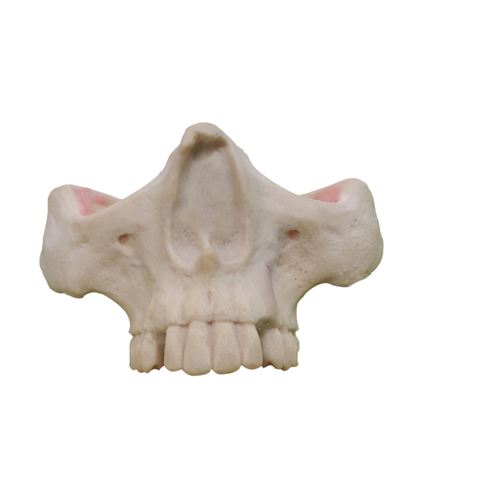 MAXILA COM CANINO + 3º MOLAR INCLUSO - ODONTOLOGIA