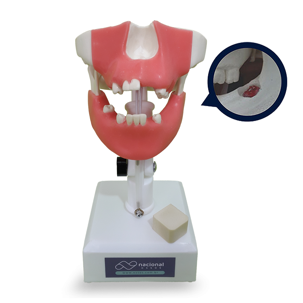 MANEQUIM PRE MOLAR COM 3º MOLAR INCLUSO E GENGIVA - ODONTOLOGIA