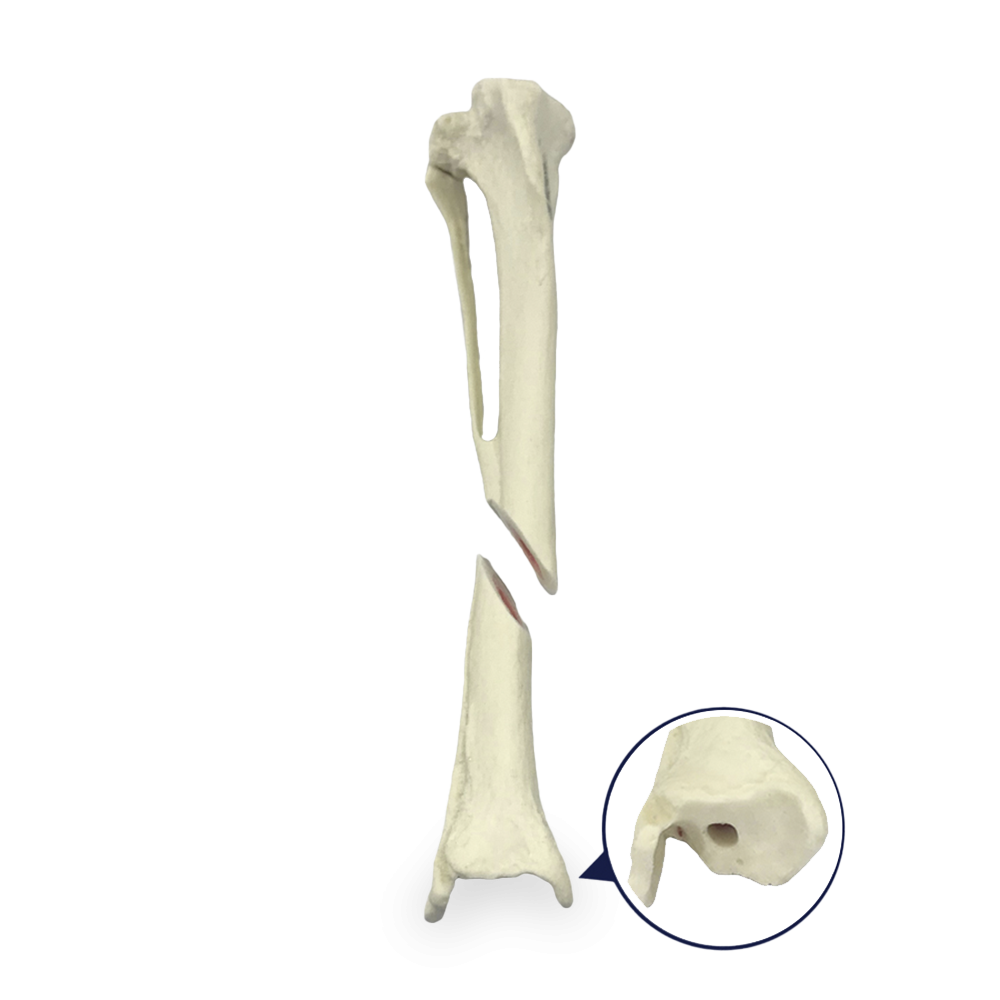 Tíbia Direita com Fratura Distal – Cão Grande | Nacional Ossos AV210ESPF2
